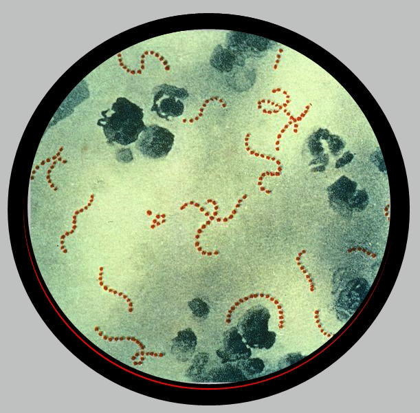 La bacteria Streptococcus pyogenes que está causando alarma en Argentina